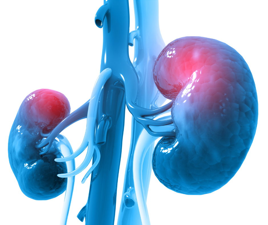 What your Stem cells can do for your Kidneys - Stemregen
