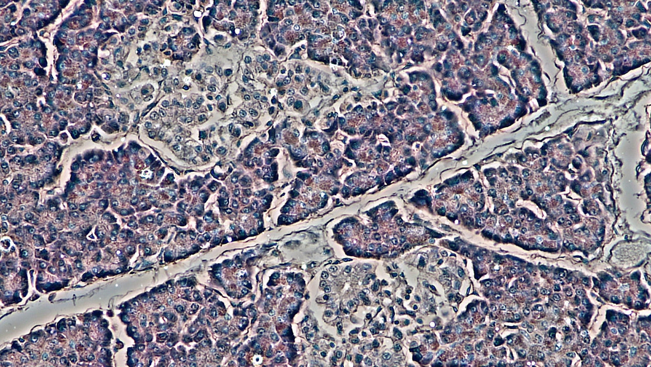 Endogenous Stem Cell Mobilization - Stemregen